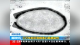 西伯利亚冻土中发现史前巨型病毒 仍具感染性