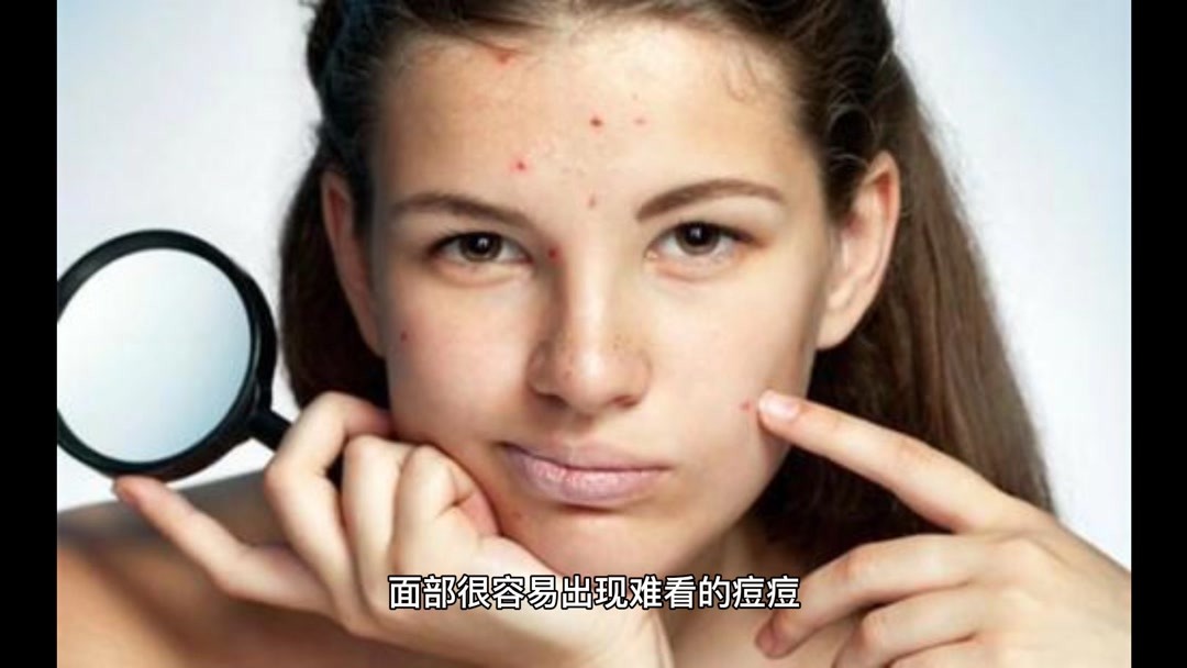 去痘印有效的办法,现在知道还不晚