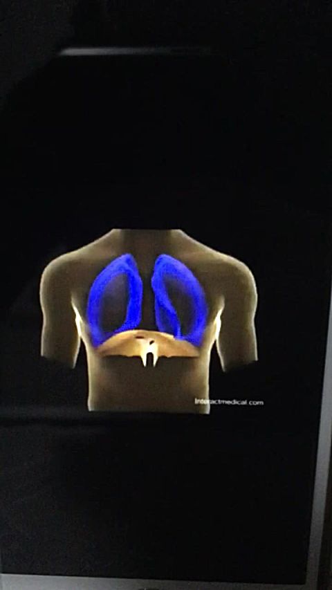横膈膜的运动 虎翼视频
