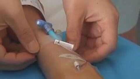 静脉滞留针教程 常用护理操作讲解
