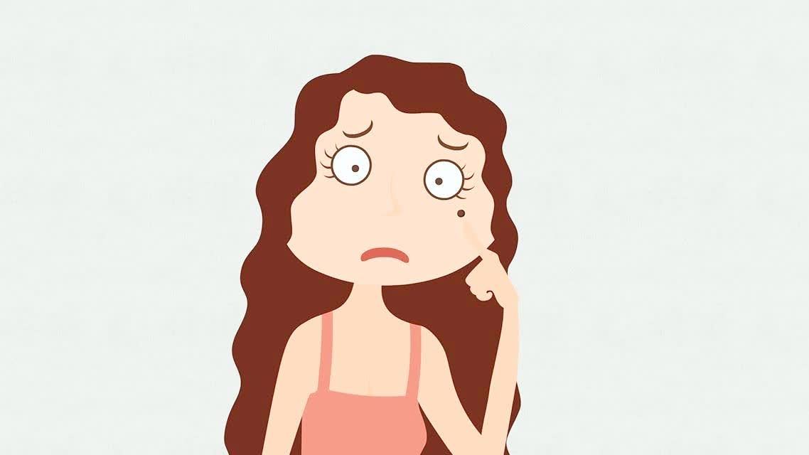 什么是痣,痣怎么去除?需要去除吗?