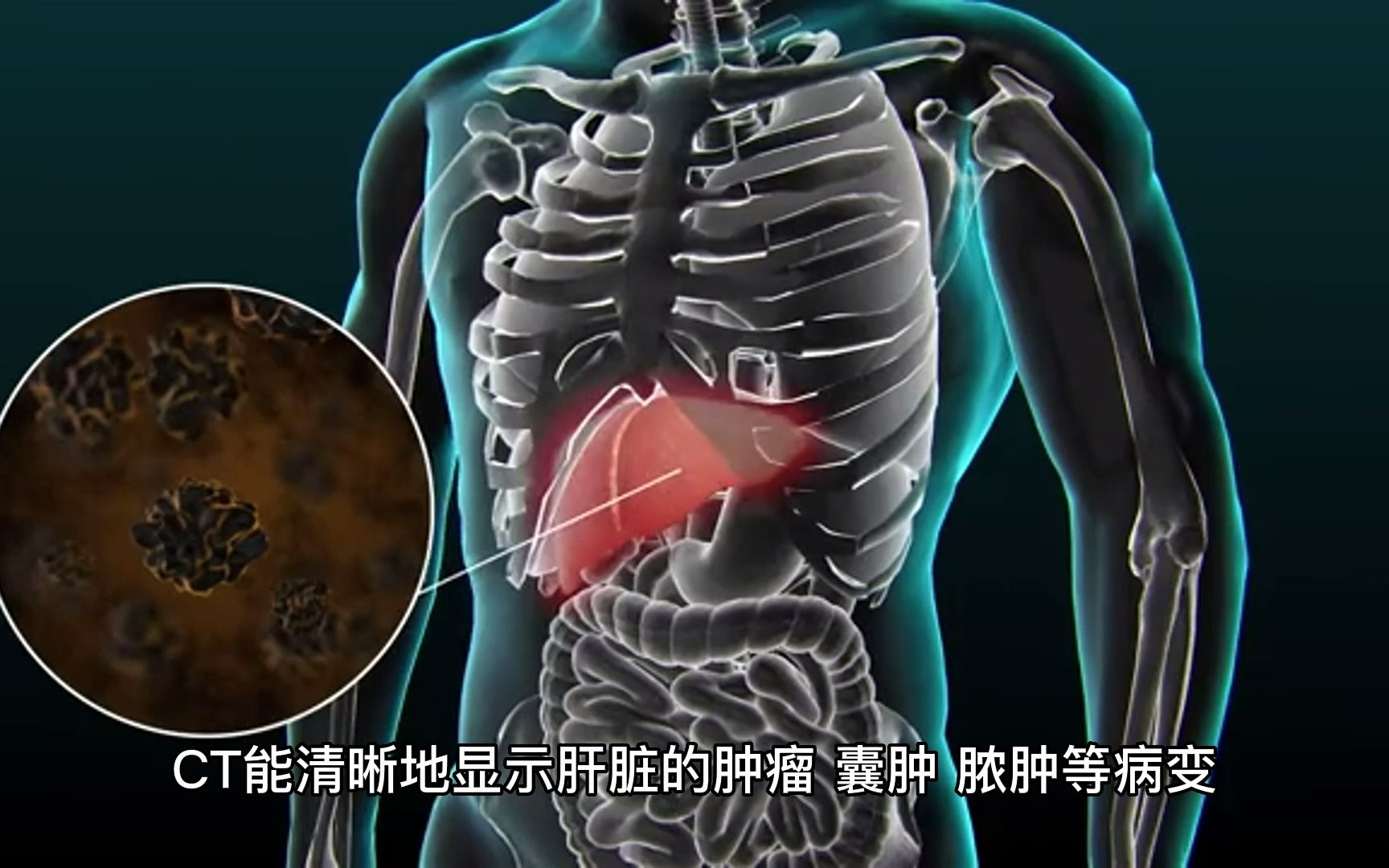 CT能检查什么病?