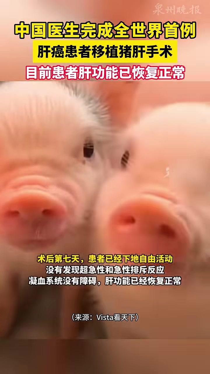 中国医生完成全世界首例肝癌患者移植猪肝手术,目前患者肝功能已...