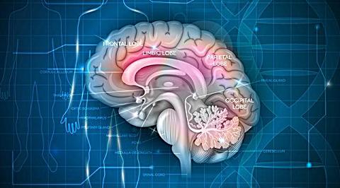 脑梗塞的新治疗方法-颅内动脉取栓术