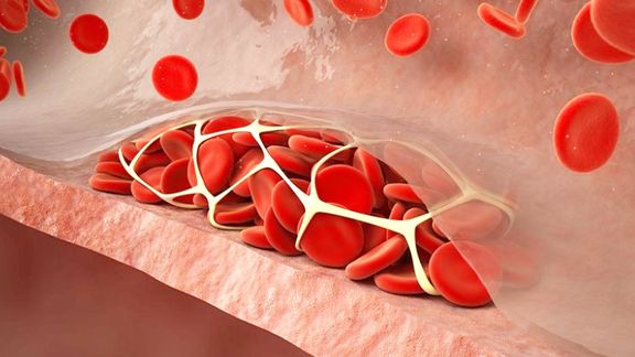 血管不通畅时,人体会出现三个症状,自己对照一下,看看堵了吗?