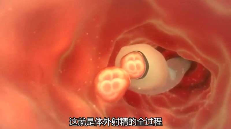 试管婴儿手术到底有多疼?3D动画演示全程,看完让人心疼不已!
