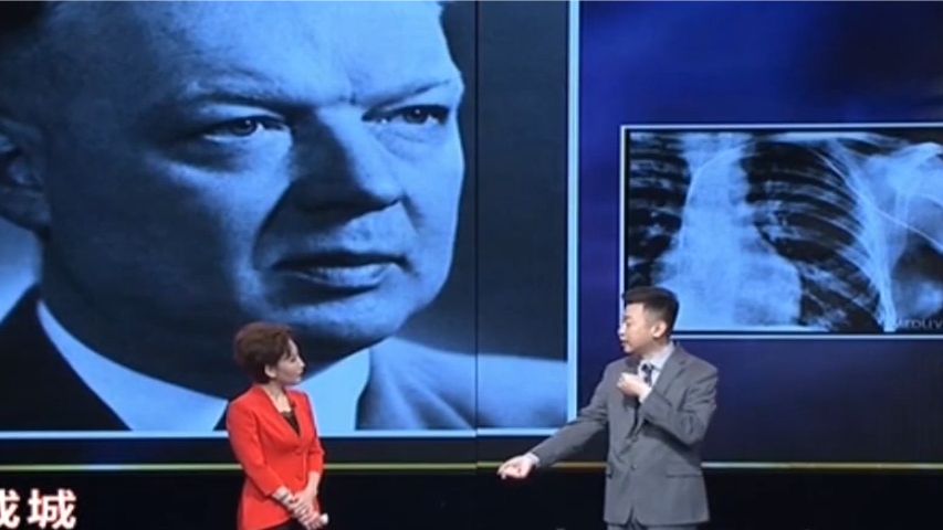 世界上第一例冠脉造影术:福斯曼医生,亲手将尿管插入自己心脏