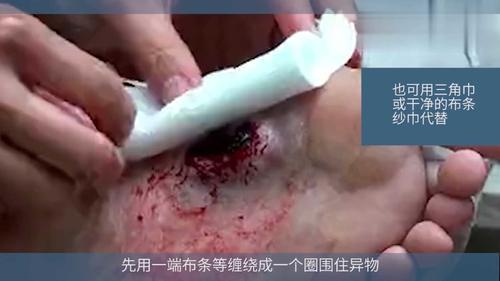 脚部擦伤且伤口有异物的情况下如何急救处理