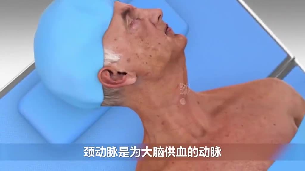 医生提醒:身体有这4个表现,多是颈部血管堵了!这样做能疏通
