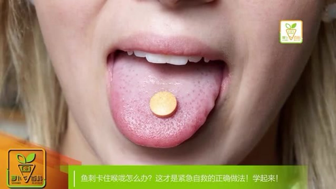 鱼刺卡住喉咙怎么办?这才是紧急自救的正确做法!学起来!