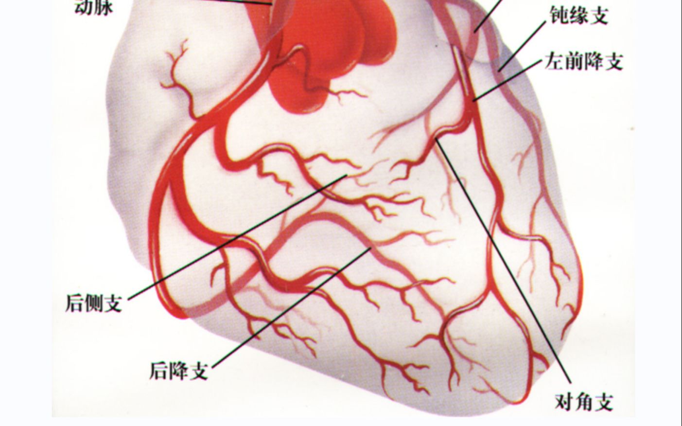 4-冠状动脉造影结果判读