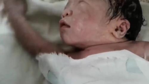 刚出生的宝宝一直没反应,医生拼命的用手弹!