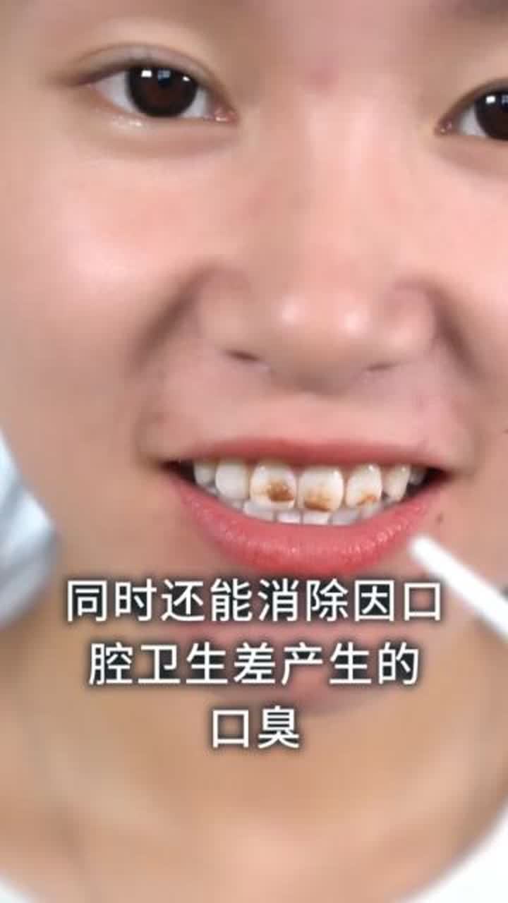 冲牙器有什么作用