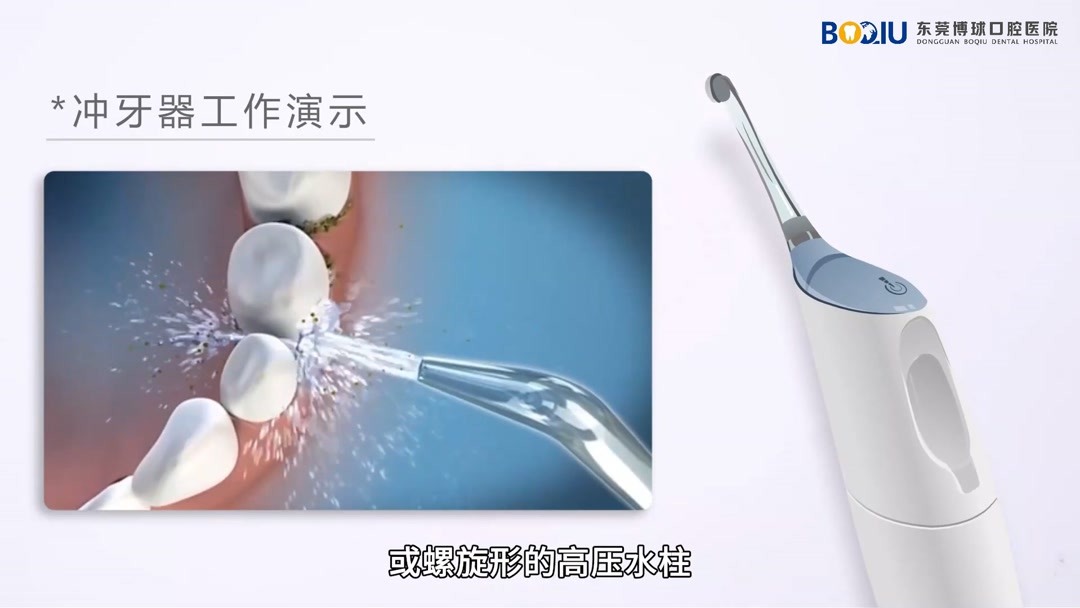 冲牙器应该如何使用?冲牙器的正确使用方法
