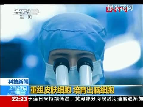 研究称免疫细胞可"饿死"HIV病毒