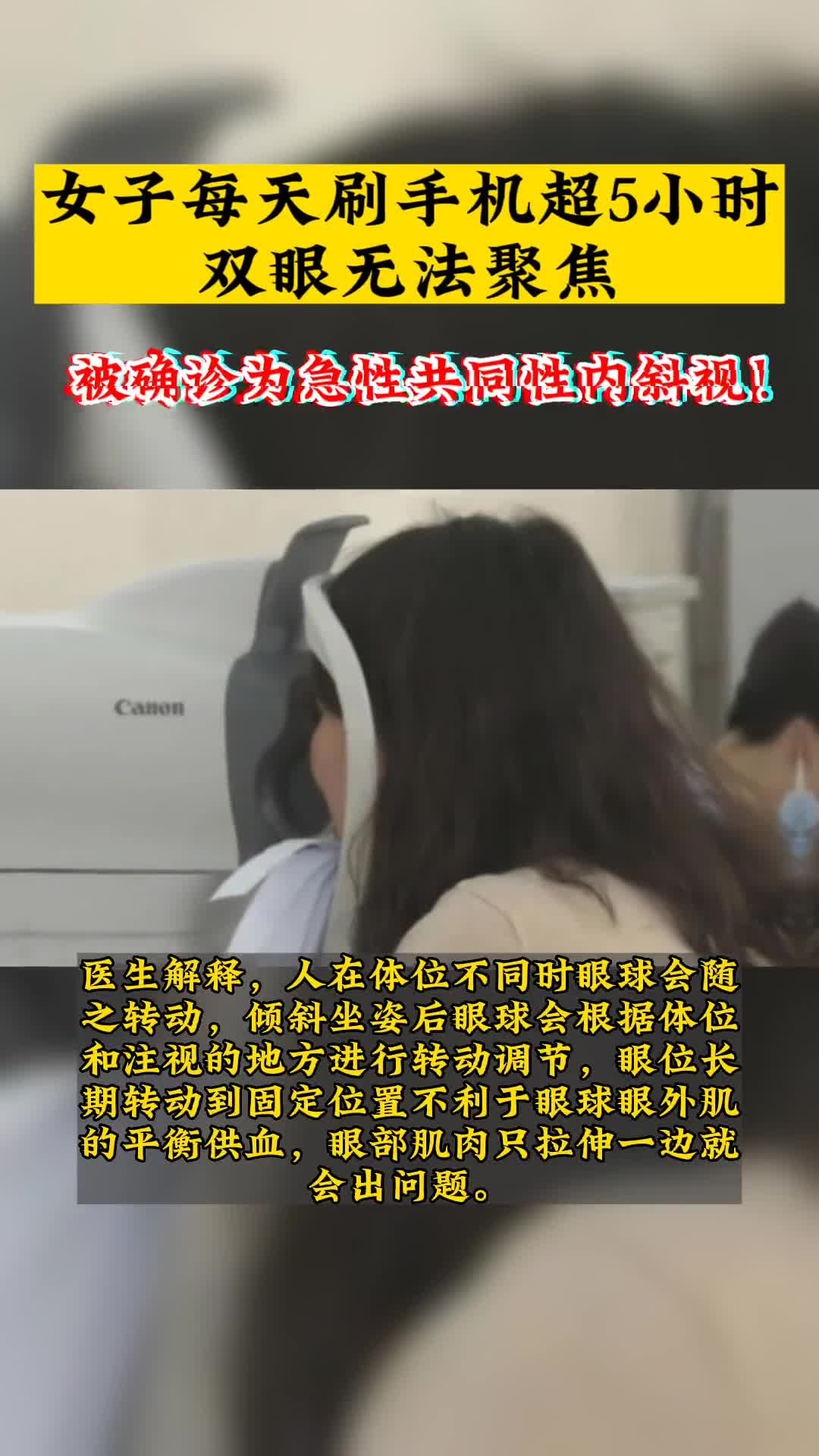 女子每天刷手机超5小时,双眼无法聚焦!被确诊为急性共同性内斜视!