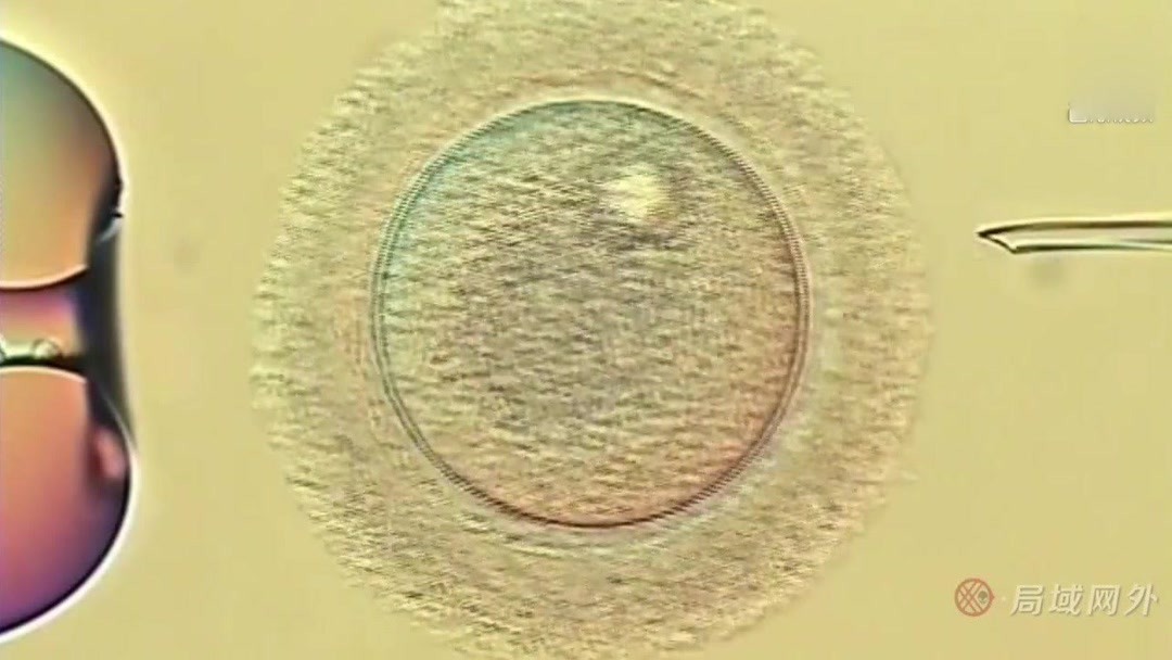 揭秘试管婴儿人工受精过程,这针应该是纳米级的吧