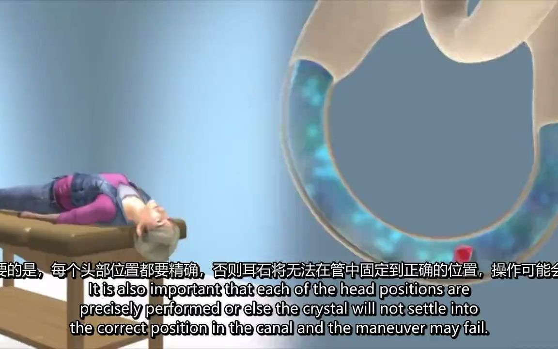 深头悬位手法-治疗良性阵发性位置性眩晕(上/前半规管)(Deep Head ...