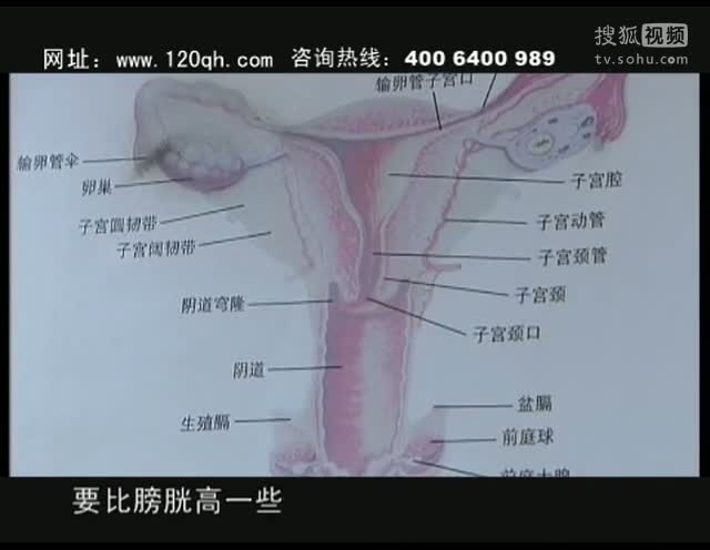输卵管上举为什么导致输卵管性不孕