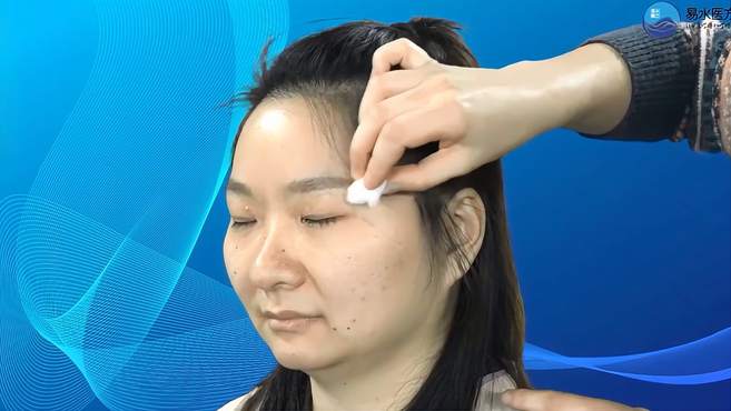 头痛、眩晕、口歪眼斜、目赤肿痛,丝竹空透太阳,刘晓庆古法针灸