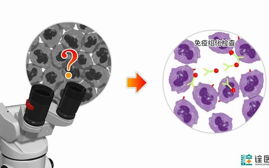 甲状腺细针抽吸细胞学检查