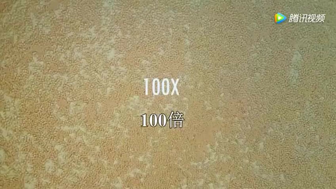 血液在电子显微镜下100倍放大到1000倍,猜猜看到了什么?