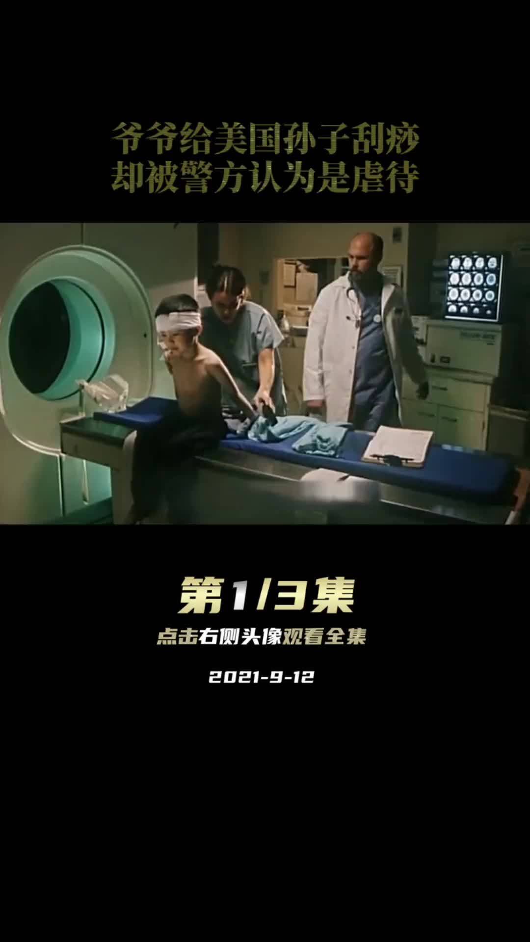 中国的刮痧疗法,被美国认为是犯罪