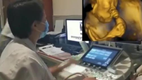 做产检宝宝手遮到脸,医生夸完宝宝后,宝宝非常配合地拿开小手