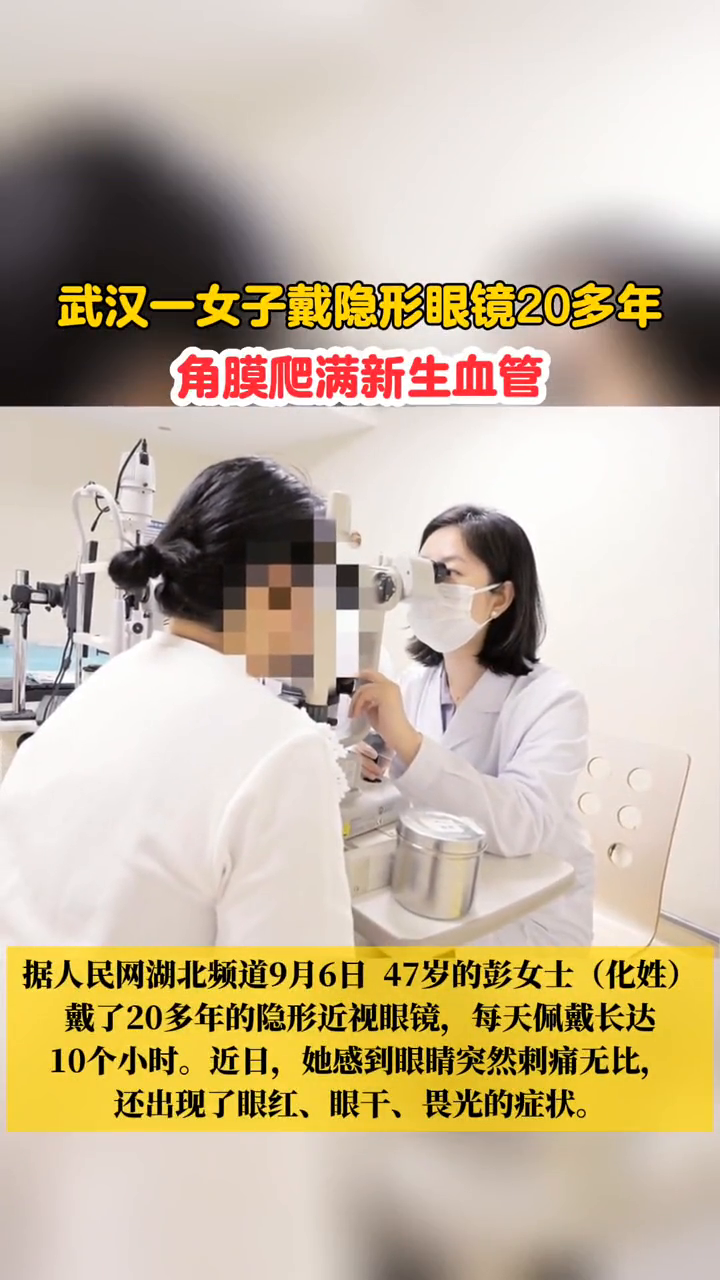 武汉一女子戴隐形眼镜20多年角膜爬满新生血管03