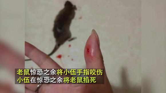 安徽一姑娘宾馆睡觉 半夜竟被老鼠咬伤 惊恐之余掐死老鼠