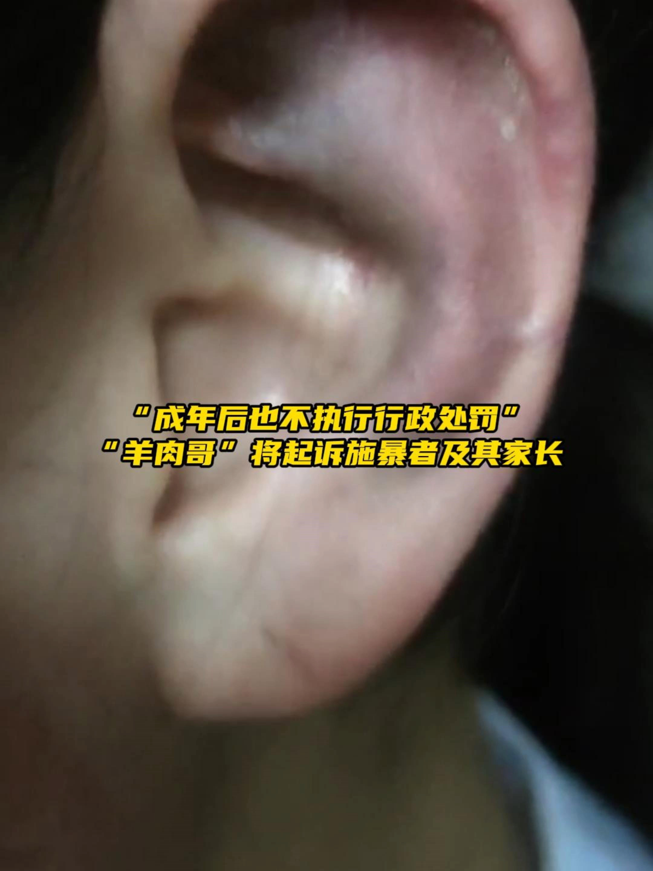 成年后也不执行行政处罚,"羊肉哥"将起诉施暴者及其家长