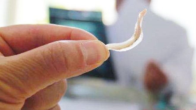 4个日常生活中最常见的问题急救方法,连鱼刺卡喉咙都能轻松解决