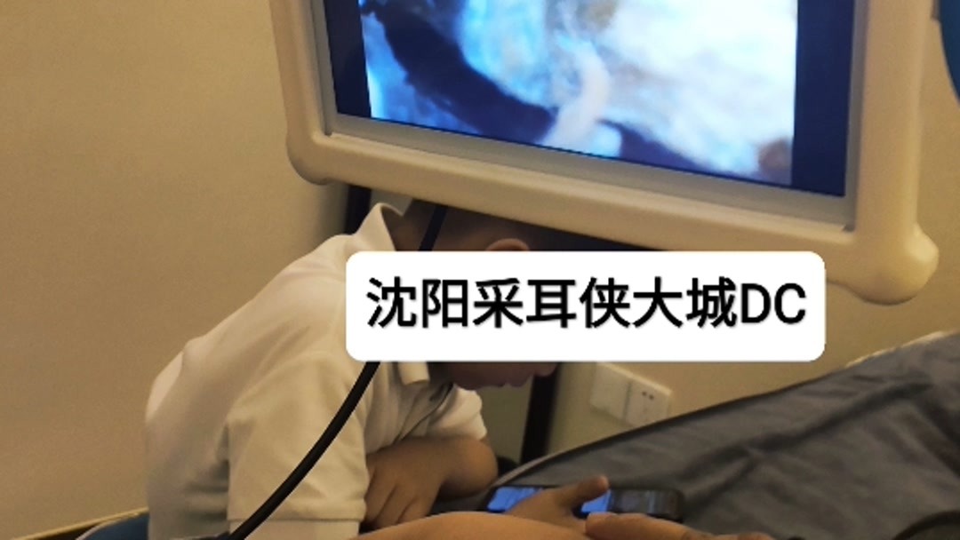 可视采耳师大城DC沈阳采耳侠大城 耳道霉菌感染 真菌感染 耵聍栓塞等