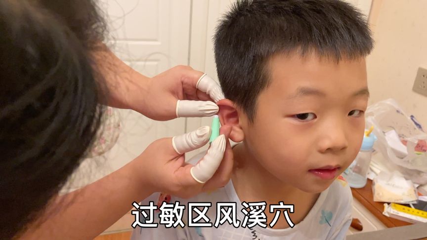 中医特色疗法#耳尖放血