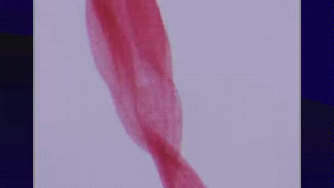 曼氏迭宫绦虫 它是怎么寄生的,你们知道么?