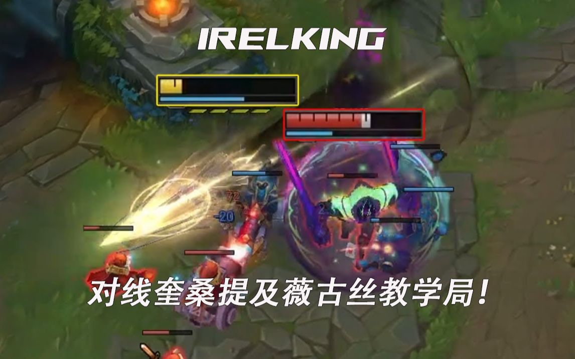 IRELKING:韩一刀妹教你如何对线薇古丝和奎桑提!