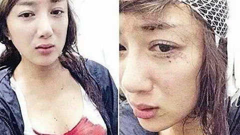 她曾是当红的古装美人,后被狗咬成“毁容”,今仍有后遗症