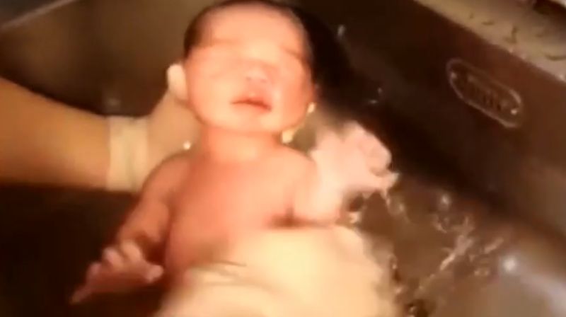 实录刚出生婴儿护理过程,准妈妈都要学一学!