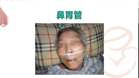 贝安馨养老护理——管道与转运(1)