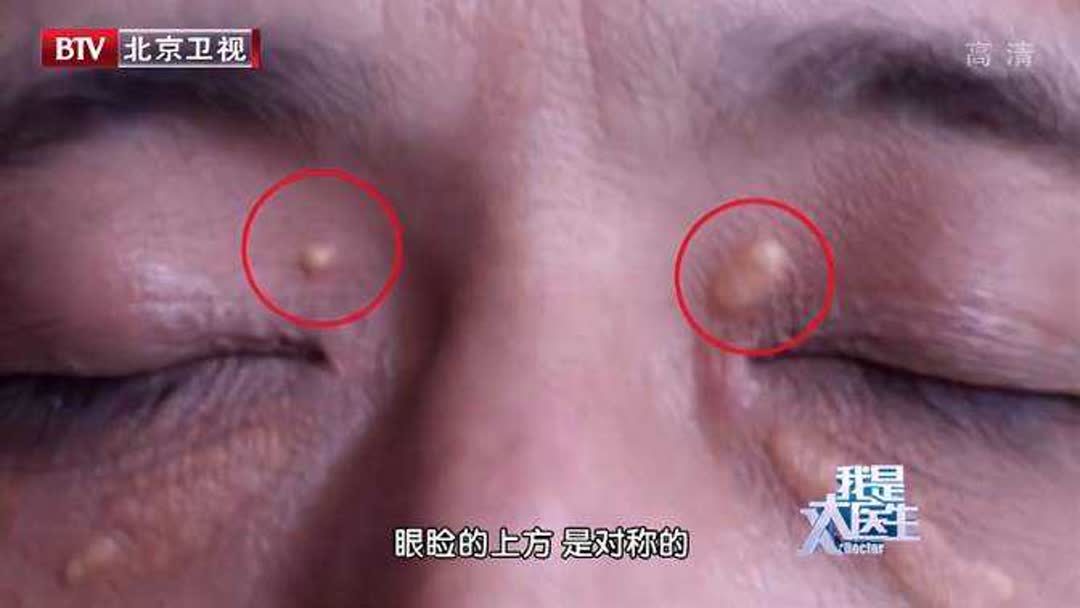 血管存在异物,有哪些外在特征?专家:这些症状不能忽视!