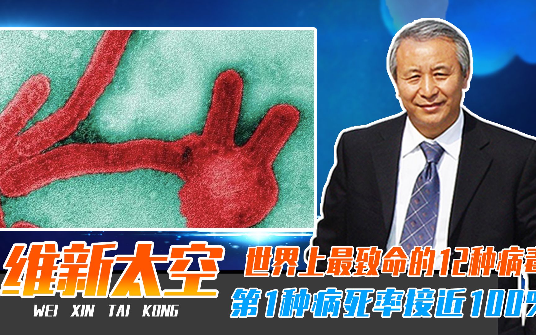 世界上最致命的12种病毒,到底有多可怕?第1种病死率接近100%