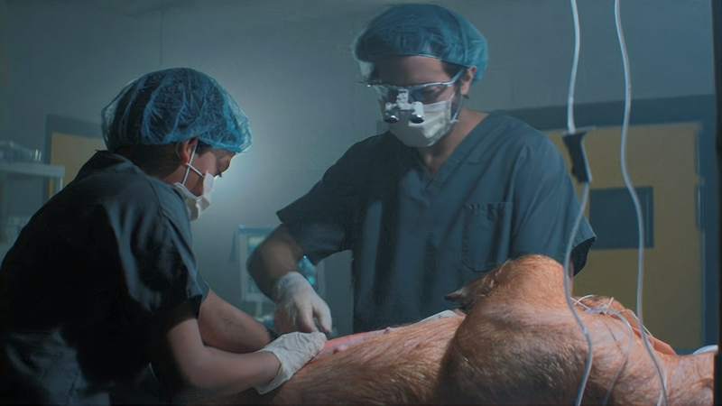 医生给妻子移植猪的器官,本以为能帮她治疗绝症,没想到酿成大错