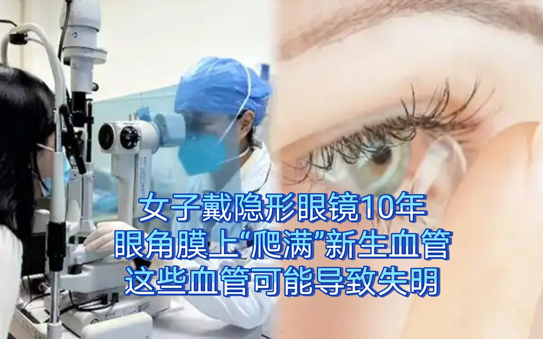 女子戴隐形眼镜10年,眼角膜上“爬满”新生血管,医生:她每天戴10个...