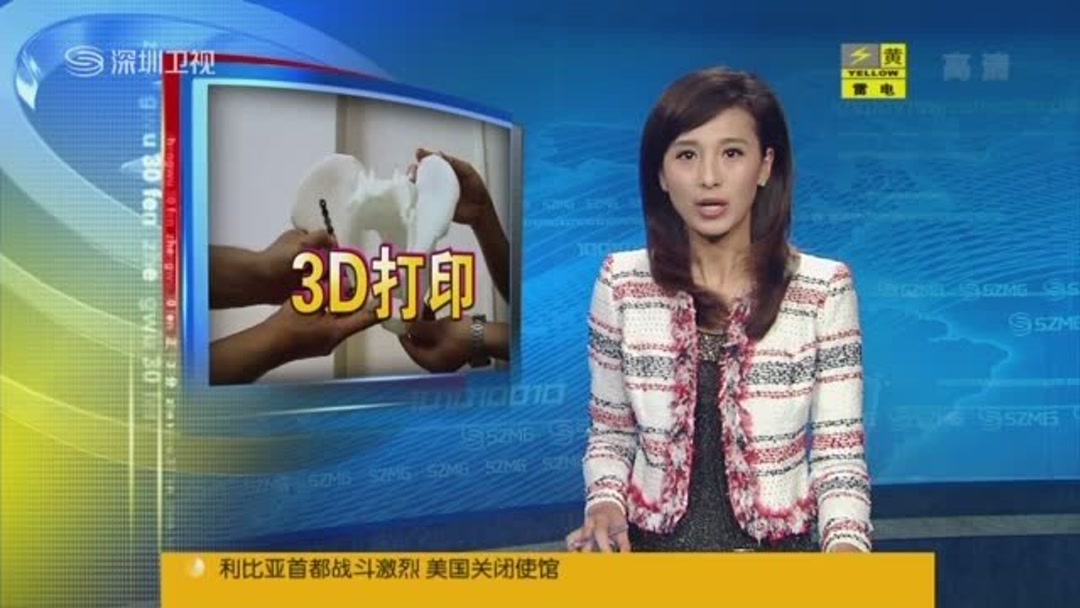 贵州:医学治疗运用3D打印 骨科手术获得成功