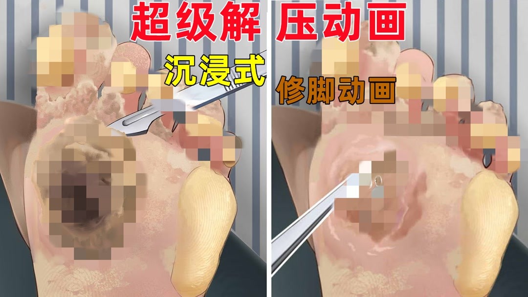 沉浸式修脚清除厚茧子,第一视角体验超解压动画,干净卫生又下饭