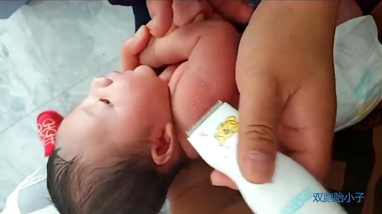 第一次听说小婴儿还有这种病,处理方法还这么简单粗暴?