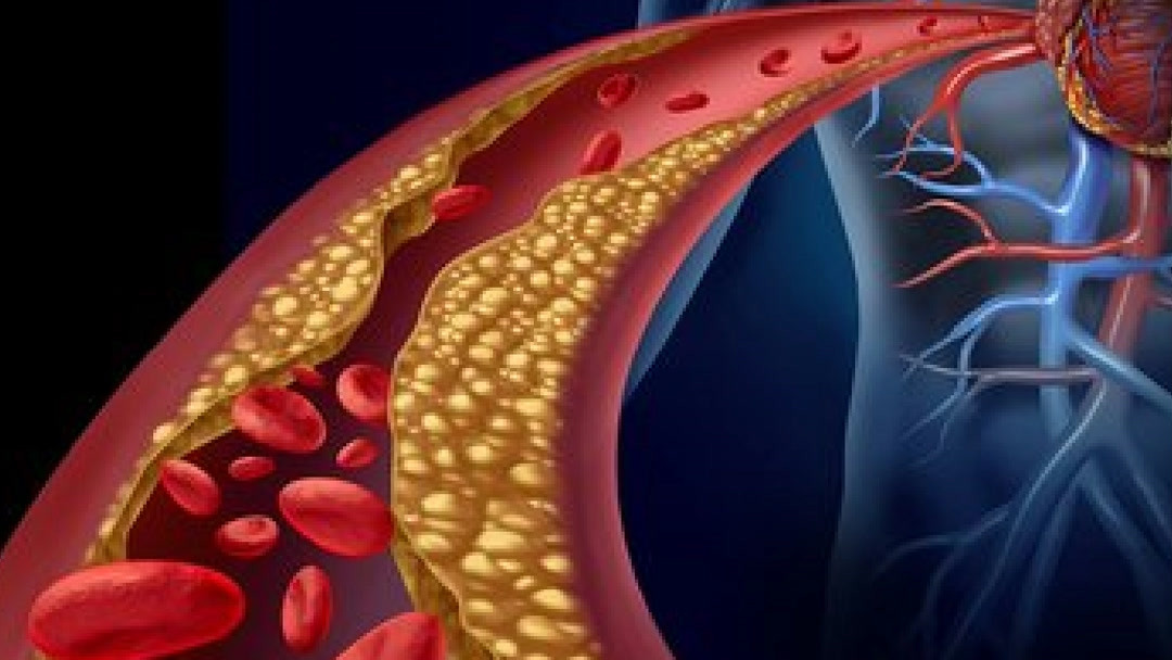 血管堵塞怎么办?这几个症状早已“露马脚”!没发现就危险 了!