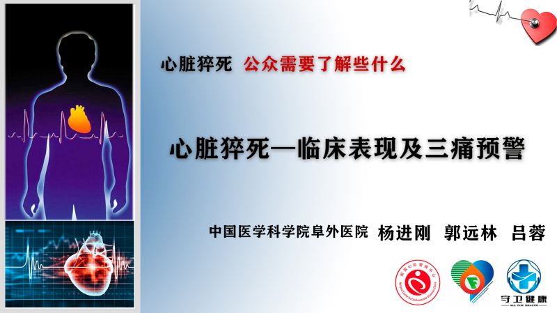 心脏猝死1临床表现