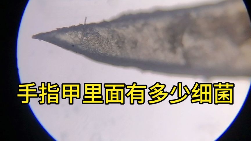 你的手指甲里面有多少细菌,放大600倍让你一看究竟!