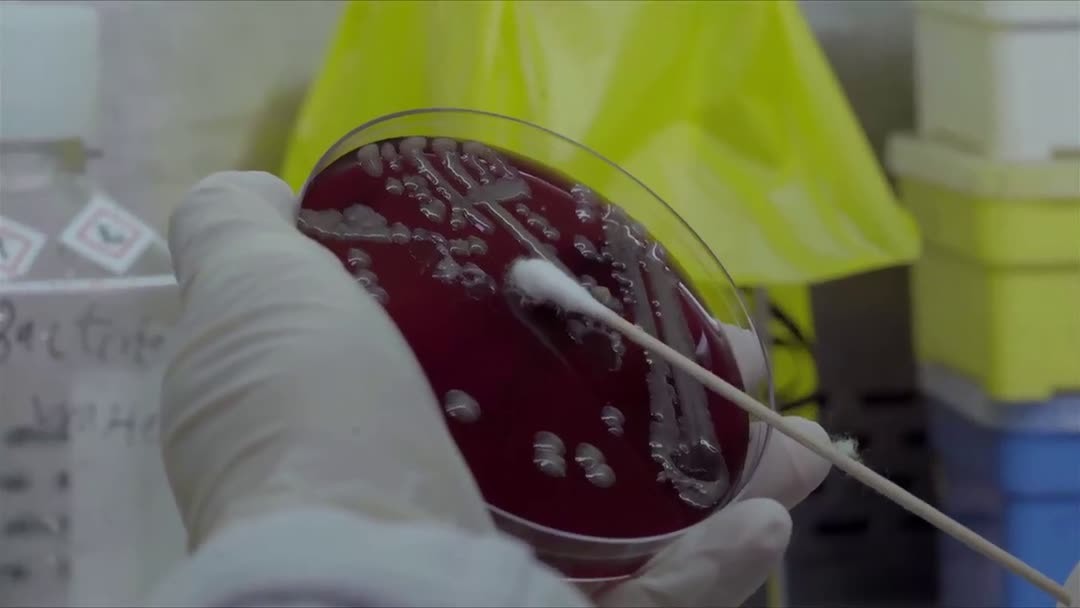 第2集 细菌之战